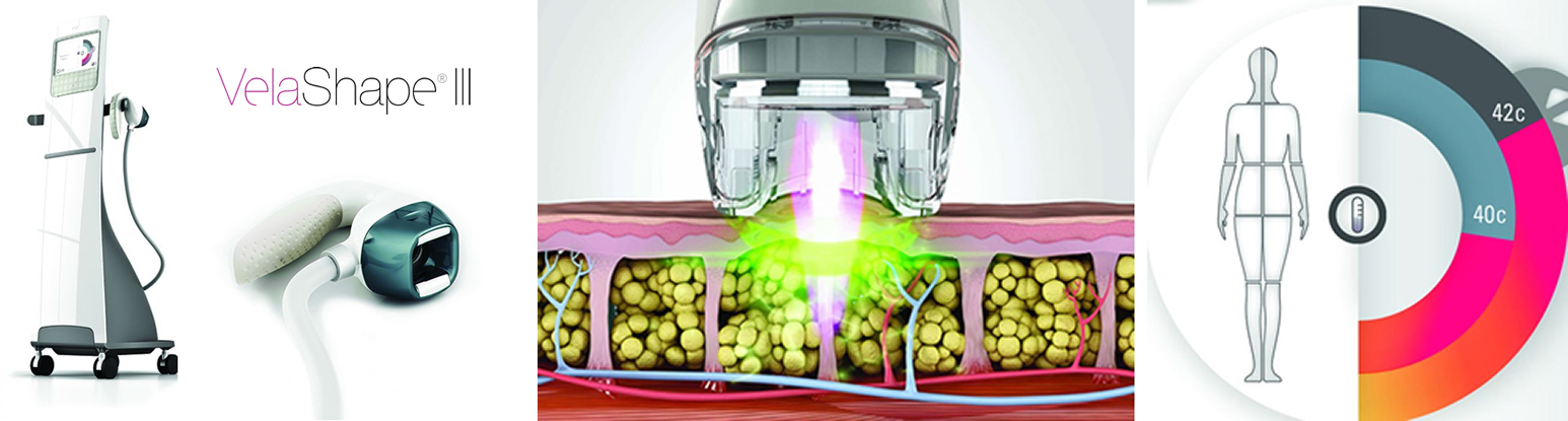 VelaShape III – EgoClinic